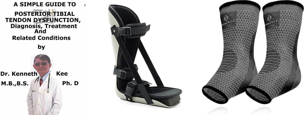 5 Top Braces for Posterior Tibial Tendon Dysfunction